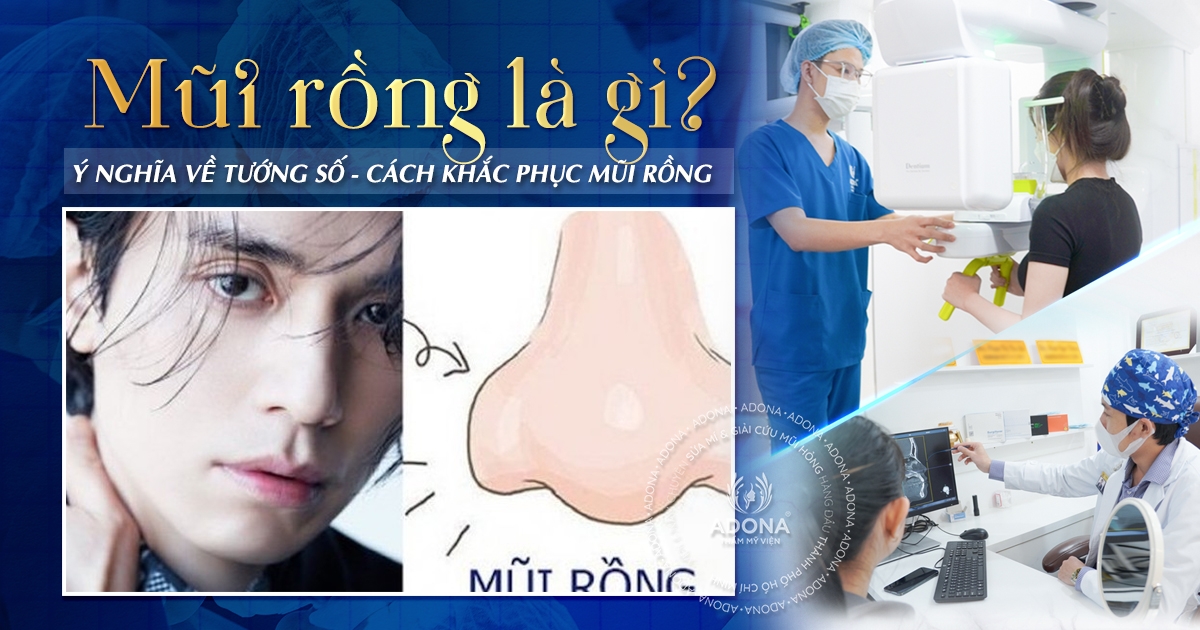 Mũi rồng là gì? Ý nghĩa về tướng số , Cách khắc phục mũi rồng - THẨM MỸ ...