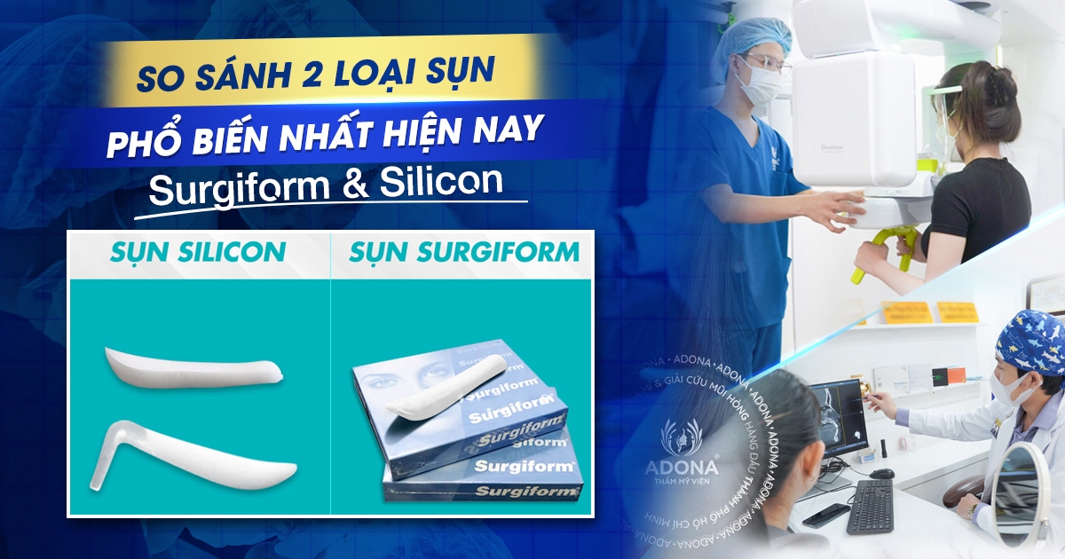 So sánh 2 loại sụn phổ biến nhất hiện nay: sụn Surgiform và sụn ...